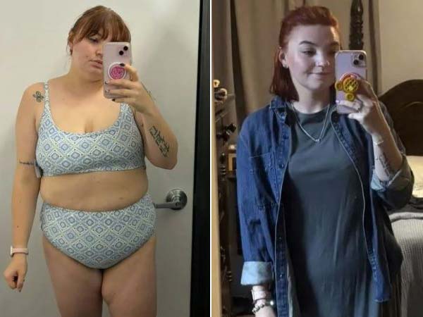 “다이어트 주사 맞았다가 부작용”… 英 여성, 결국 ‘이 방법’으로 21kg 감량 성공 - 당신의 건강가이드 헬스조선